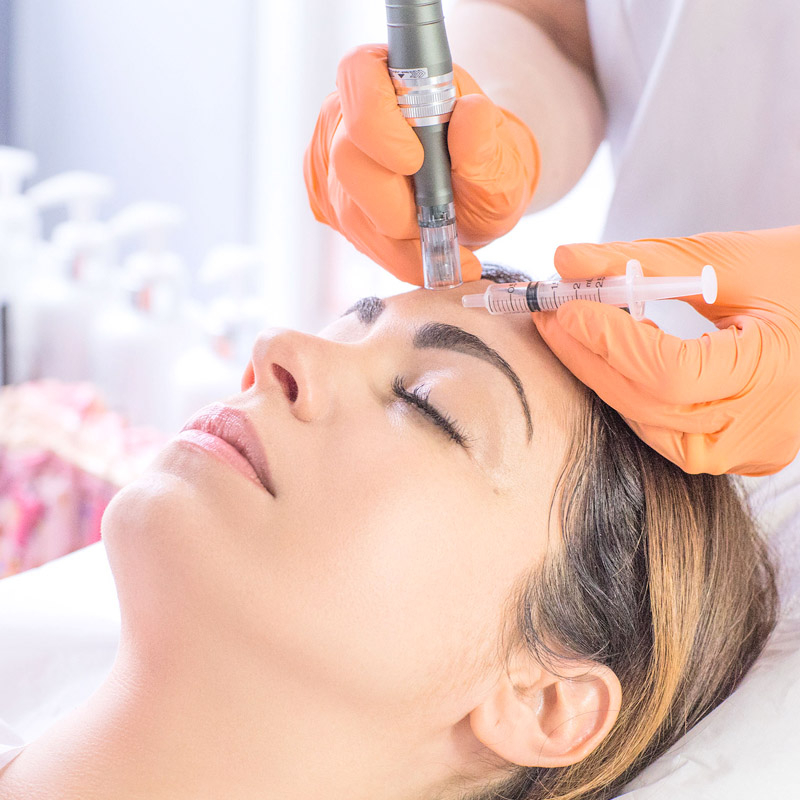 Le Microneedling Anti Age Institut Zenaura Bron