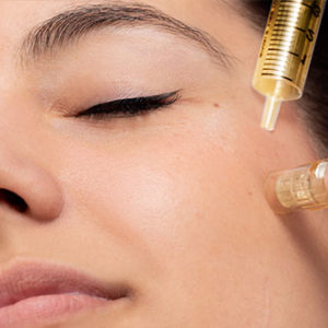 Le Microneedling Anti Age - Institut Zenaura Bron