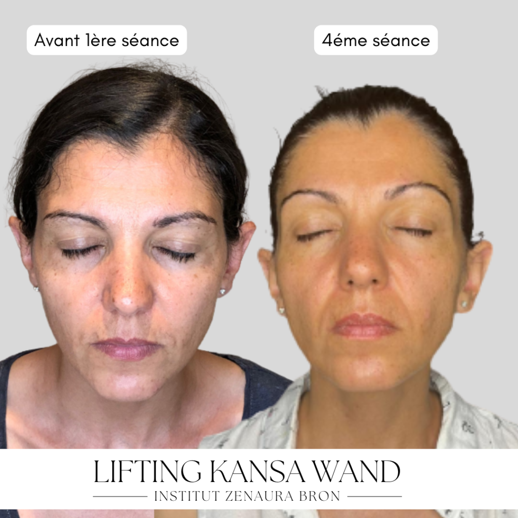 Centre amincissement BRON - Institut Zenaura